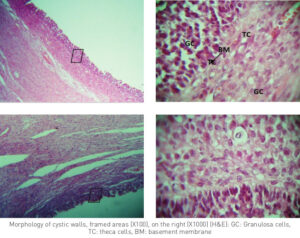 Ovarian cysts in cattle: a review - VETERINARSKA STANICA